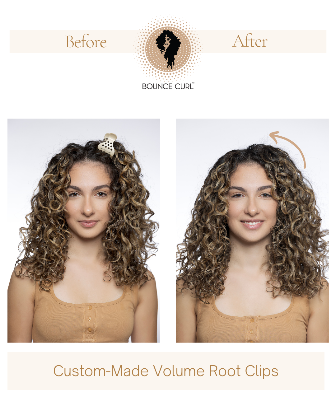Volume Root Clips